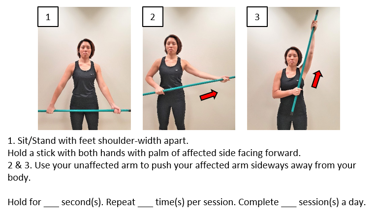 standing exercises physiotherapy